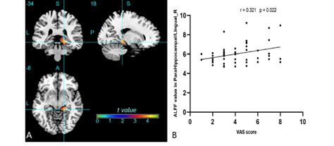 A Resting State Fmri Image Of The Brain Showing Greater Amplitude Of Download Scientific