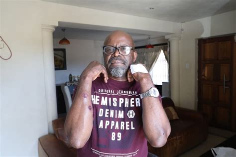 Actor Patrick Shai Shot 11 Times By Cops During Soweto Protest Over Disconnected Electricity