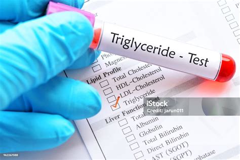 Tabung Sampel Darah Untuk Tes Trigliserida Foto Stok Unduh Gambar Sekarang Trigliserida