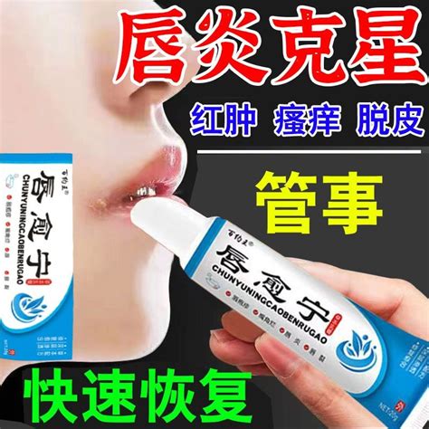 Cheilitis Irritation And Blistering In The Mouth Chapped Lips Chronic