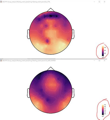 Eeg 2d Disc Topography Scale Discussions Brainstorm