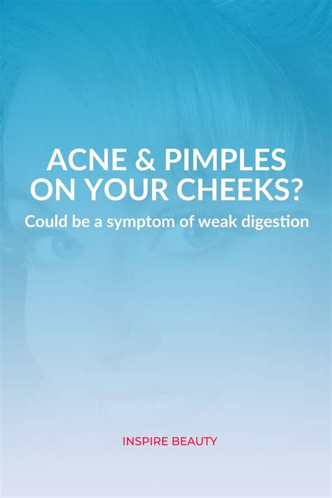 What Could Be Causing Acne Breakouts On Your Cheeks Inspire Beauty