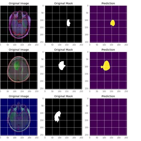 Segmentation Results Of The Fcn Architecture Download Scientific Diagram