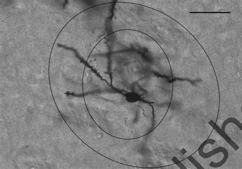 Photomicrograph Of A Medium Spiny Neuron Of The Nucleus Accumbens