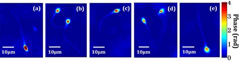 Pseudo Color Plot Of Reconstructed Phase Maps Of A Normal Sperm