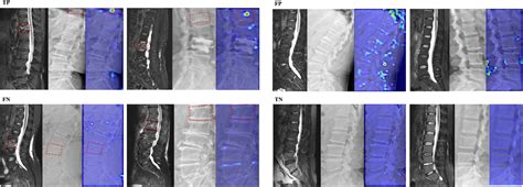 Frontiers Deep Learning Based Automated High Accuracy Location And