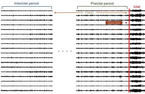Definition Of Preictal And Interictal Period Download Scientific Diagram