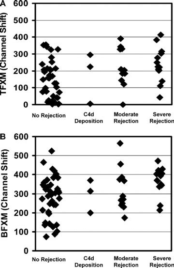 DSA Levels From Baseline To Days Posttransplant For The Low DSA Download Scientific Diagram
