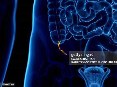 Appendix Photos And Premium High Res Pictures Getty Images