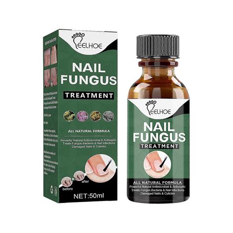 Buy 50ml Nail Fungus Treatment Toenail Fungus Treatment Extra