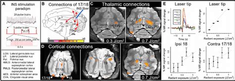 Global Connections Revealed By Ins Stimulation In Cat Visual Cortex