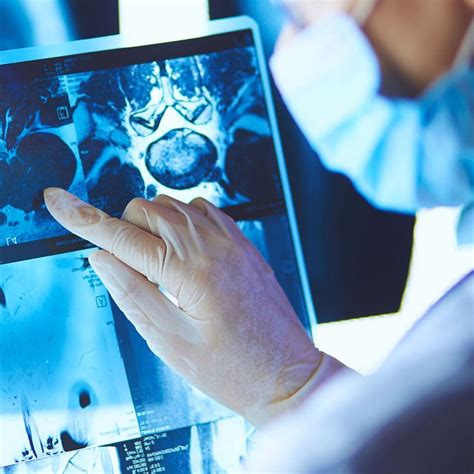 What Is A C Arm Great Lakes Imaging Madison Heights MI