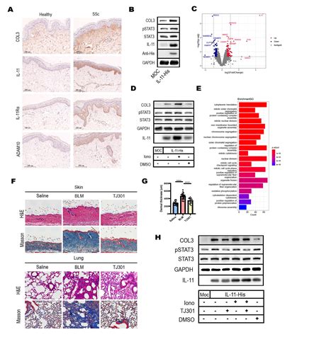 Interleukin 11 Promotes Fibrosis Through Classic And Trans Signaling