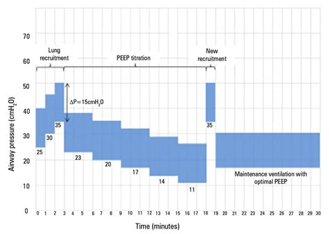 Schematic Representation Of The Alveolar Recruitment For Ards Trial