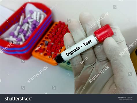 Blood Sample Digoxin Level Test Drug Stock Photo 1919345786 Shutterstock