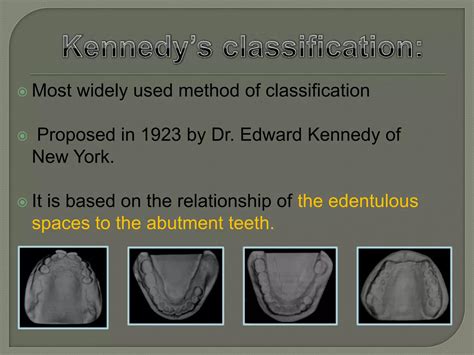 Classification Of Rpd Pptx Dental Health Diseases And Conditions