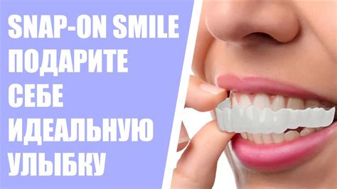 ЗУБНЫЕ ВИНИРЫ ЧТО ЭТО ОТЗЫВЫ ВИНИРЫ НА ЗУБЫ ЙОШКАР ОЛА 🎯 - YouTube