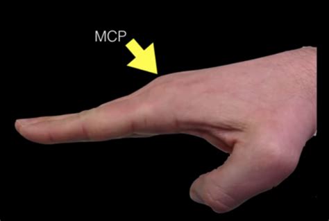 Forearm Extensors And Flexors Flashcards Quizlet