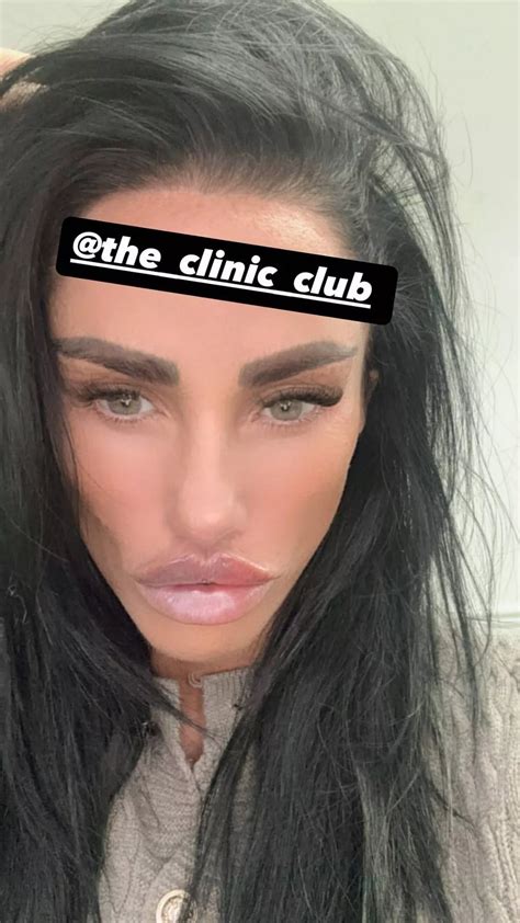 Katie Price Flaunts Biggest Lips Ever With New Filler To Pump Them Thicker Daily Star
