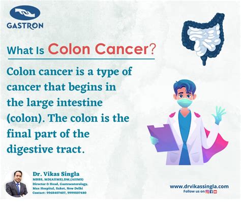 Know About The Colon Cancer Gastron
