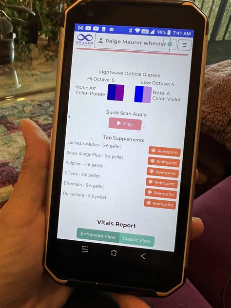 Unode Allao Scan Sì Puoi Farlo Ao Scan Global