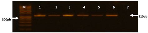 Phenotypic And Molecular Detection Of Antiseptic Resistance Genes Among Clinical Staphylococcus