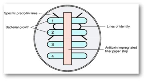 Elek Test Fundación Io