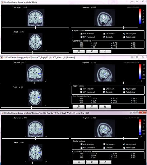 Threshold For Frequency Band Source Stats Results Discussions Brainstorm