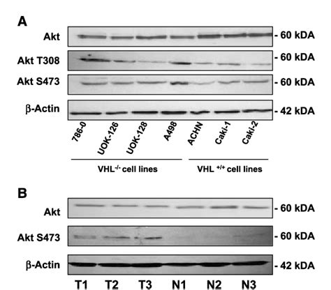 Figure 1 From The Phosphoinositide 3 Kinaseakt Pathway A New Target