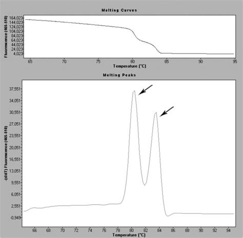 Melting Curve And Melting Peaks Charts Of A Heterozygous Mutation In