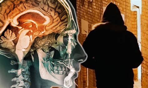 Brain Implant Could CURE Sexual Predators By ZAPPING Perverts When Impulse Strikes Science