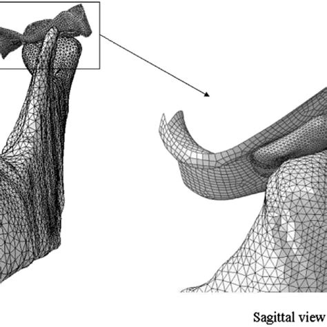 Finite Element Mesh Aoun Et Al Stress In Temporomandibular Joint Download Scientific Diagram