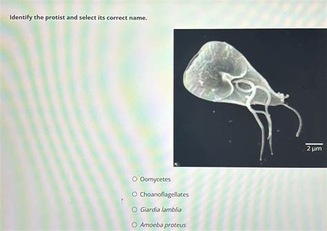 Identify The Protist And Select Its Correct Studyx
