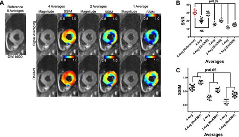 Figure From Accelerated In Vivo Cardiac Diffusion Tensor MRI Using Residual Deep Learning