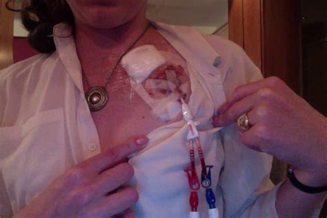 A Matter Of Life And Breath On Changes And Catheters