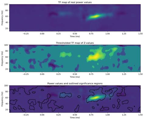 ahmed shaheen md on linkedin neural signal analysis matlab