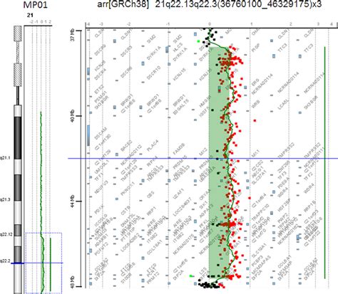 ArrayCGH Analysis Of DNA From Patient MP01 Profile Of Chromosome 21 Download Scientific