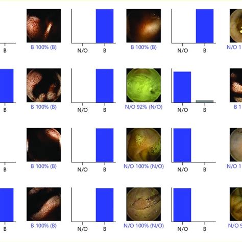 Output Obtained From The Application Of The Convolutional Neural Download Scientific Diagram
