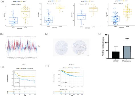 Slc14a1 Gene Is Differentially Expressed In Pca And Other Cancers And Download Scientific