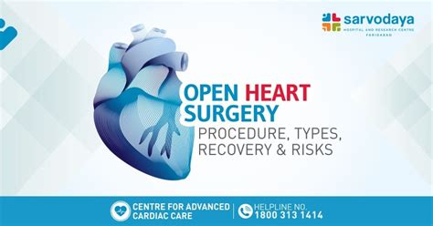 Open Heart Surgery Procedure Types Recovery And Risks