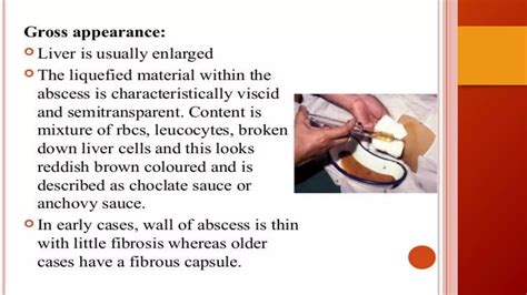 Differential Diagnosis Of Swellings In The Right Hypochondrium And Its