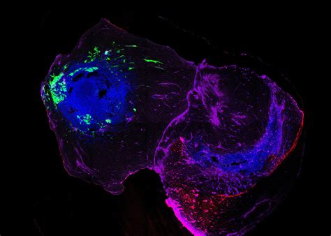 Lcsb Scientists Reveal Parkinsons Disease Spread Using Brain Assembloids University Of