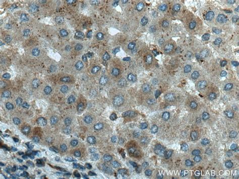 Sgk1 Antibody 28454 1 Ap Proteintech