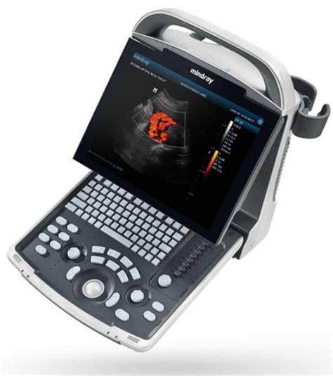 Mindray Dp 30 Probo Medical Uk