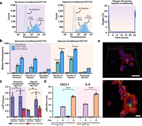 New Publication On Fusobacterium Nucleatum Infection Raffae Ahmad Posted On The Topic Linkedin