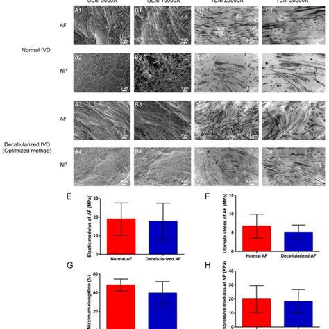 Optimized Decellularization Method Preserved Ecm Structure And
