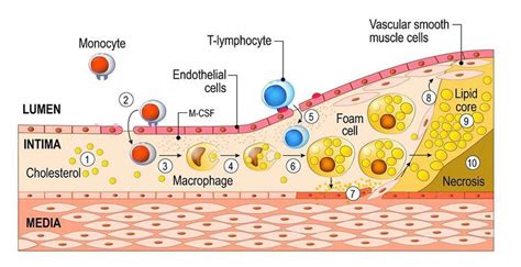 Fact Sheet Coronary Heart Disease Cppe