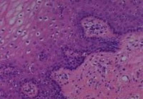 Novus Biologicals™ Human Multi Tissue Tissue Microarray Cancer Human