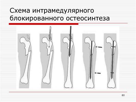 Травмы бедра и тазобедренного сустава Особенности анатомии тазобедренного сустава презентация