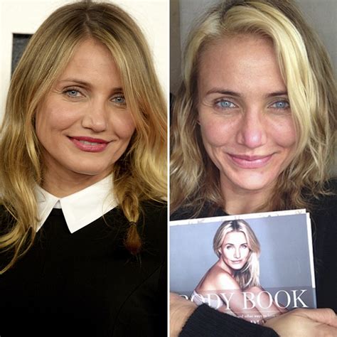 Cameron Diaz Plastic Surgery Before And After
